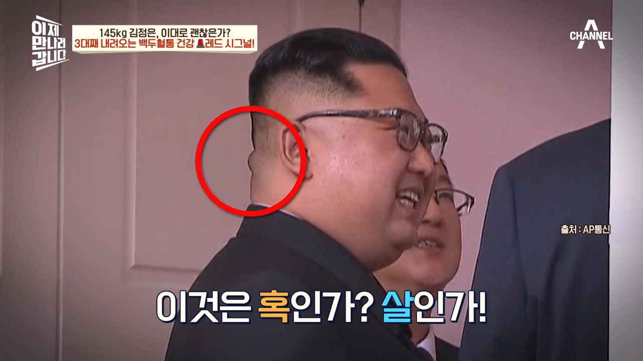 2년 만에 30kg 증량?! 몸무게와 맞물린 건강 이상까지! | ZUM TV