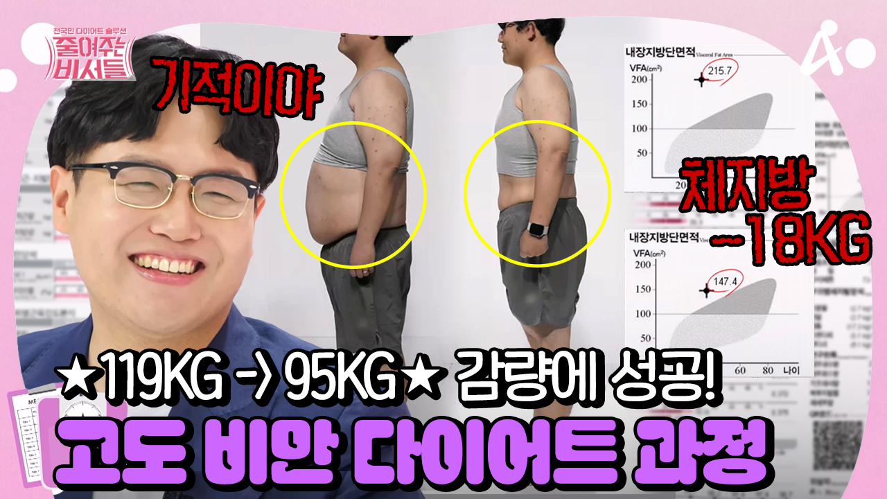 [#줄여주는비서들] 24kg 감량★ 고도 비만 탈출에 성공한 성시경 닮은 꼴! 3개월 다이어트 비결은? | ZUM TV