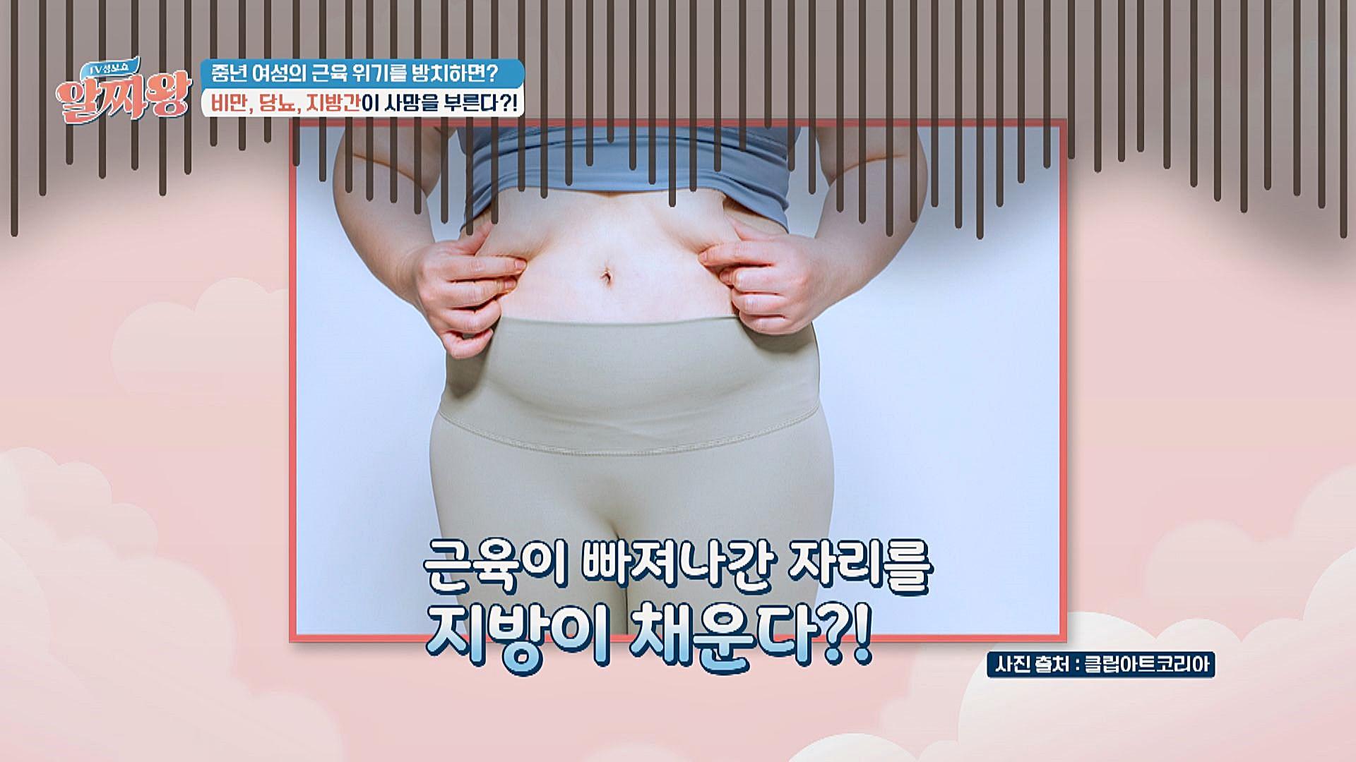 근육이 빠져나간 자리를 지방이 채운다?! 근육 관리의 중요성!💪🏻 | JTBC 240523 방송 | ZUM TV