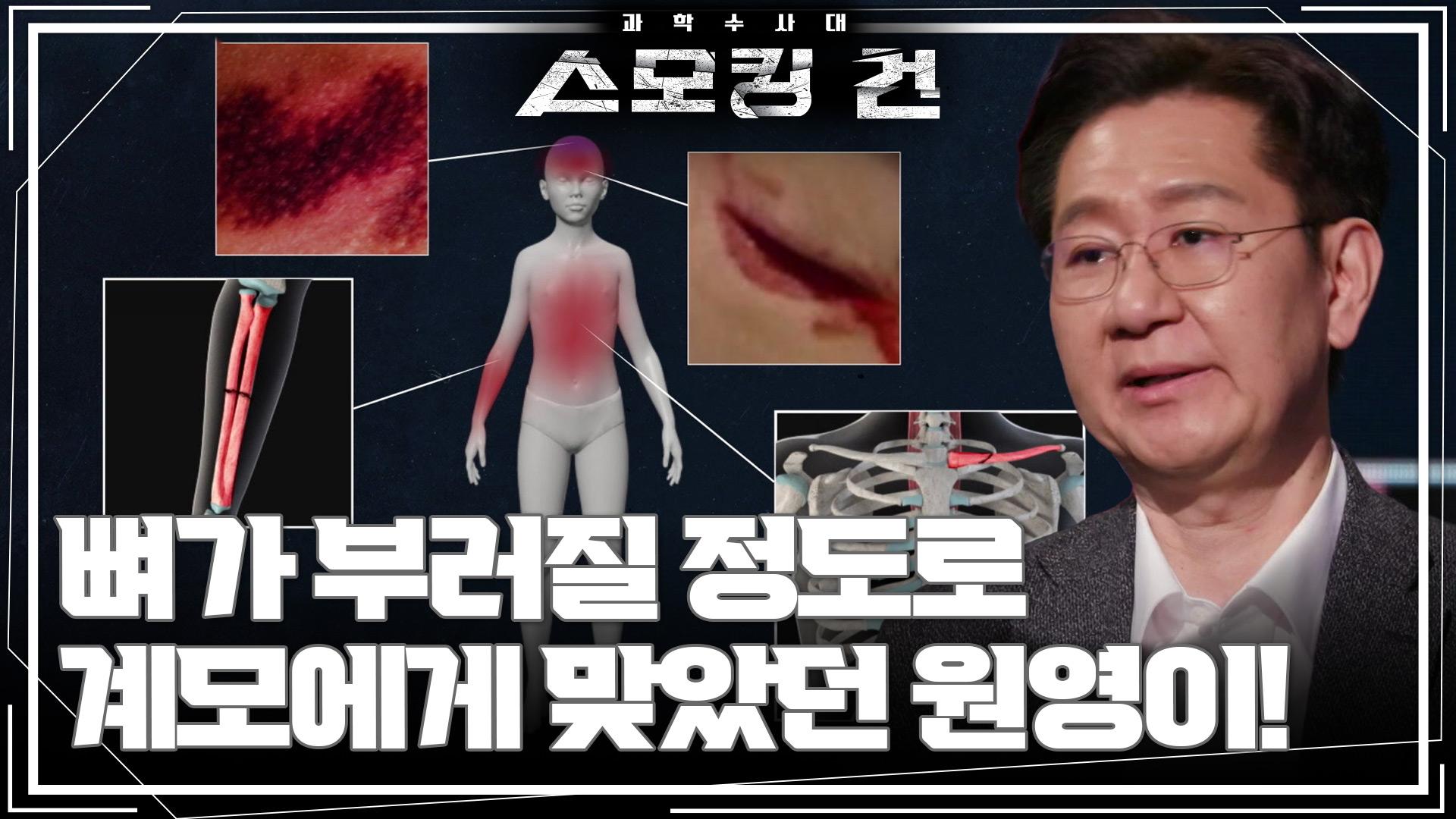 유난히 작고 말랐던 아이, 원영이의 부검 결과! | KBS 250506 방송 | ZUM TV