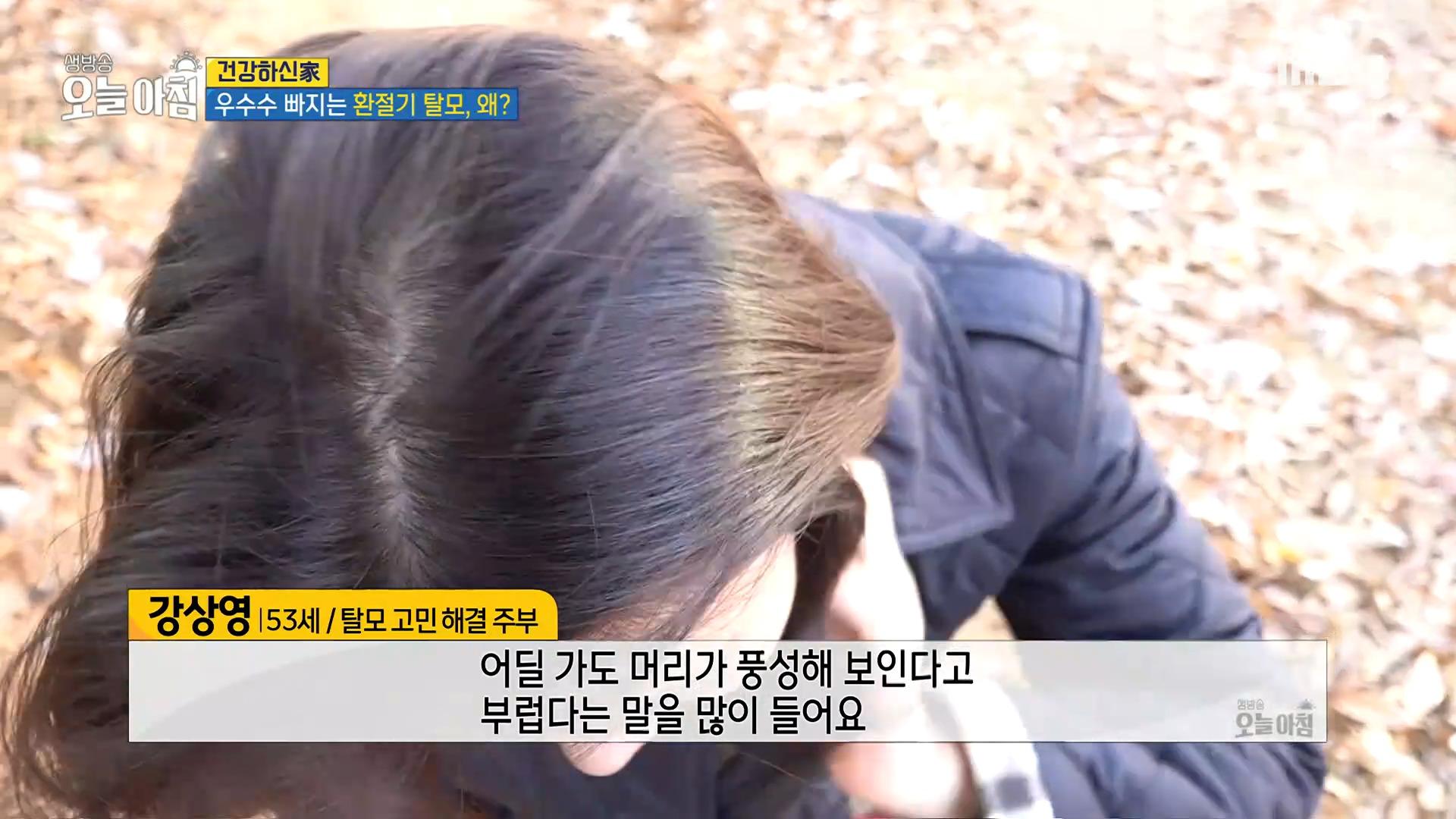 우수수 빠지는 환절기 탈모 예방법!, MBC 241120 방송 | ZUM TV
