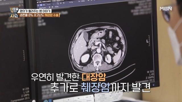 변비인 줄 알았는데 생존율 8%...?! 초고난도 췌장암 수술! MBN 220904 방송 | ZUM TV
