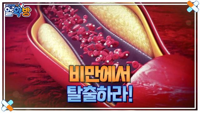 알약방 147회 ＜내 몸을 망가뜨리는 비만에서 탈출하라!＞ MBN 230420 방송 | ZUM TV