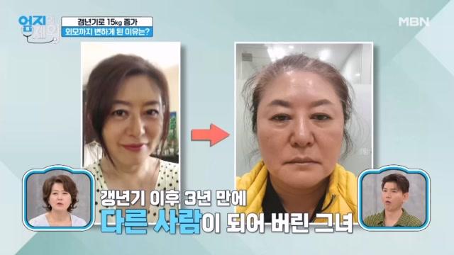 무서운 갱년기! 15kg이 증가하고 외모까지 변해버렸다? MBN 240709 방송 | ZUM TV