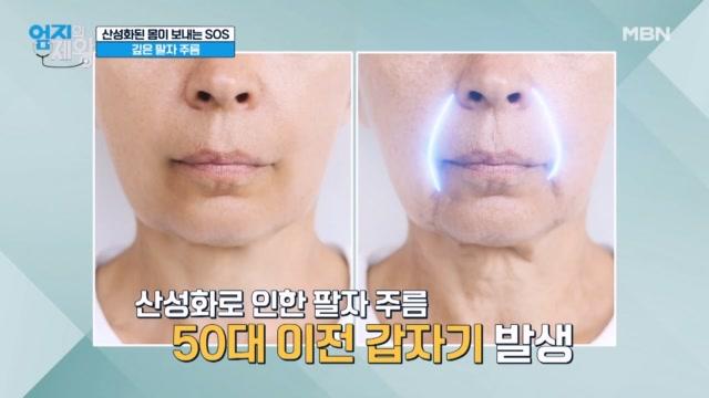 산성화된 몸이 보내는 SOS! 팔자주름? 노화 vs 산성화 팔자 주름의 차이는? MBN 240820 방송 | ZUM TV