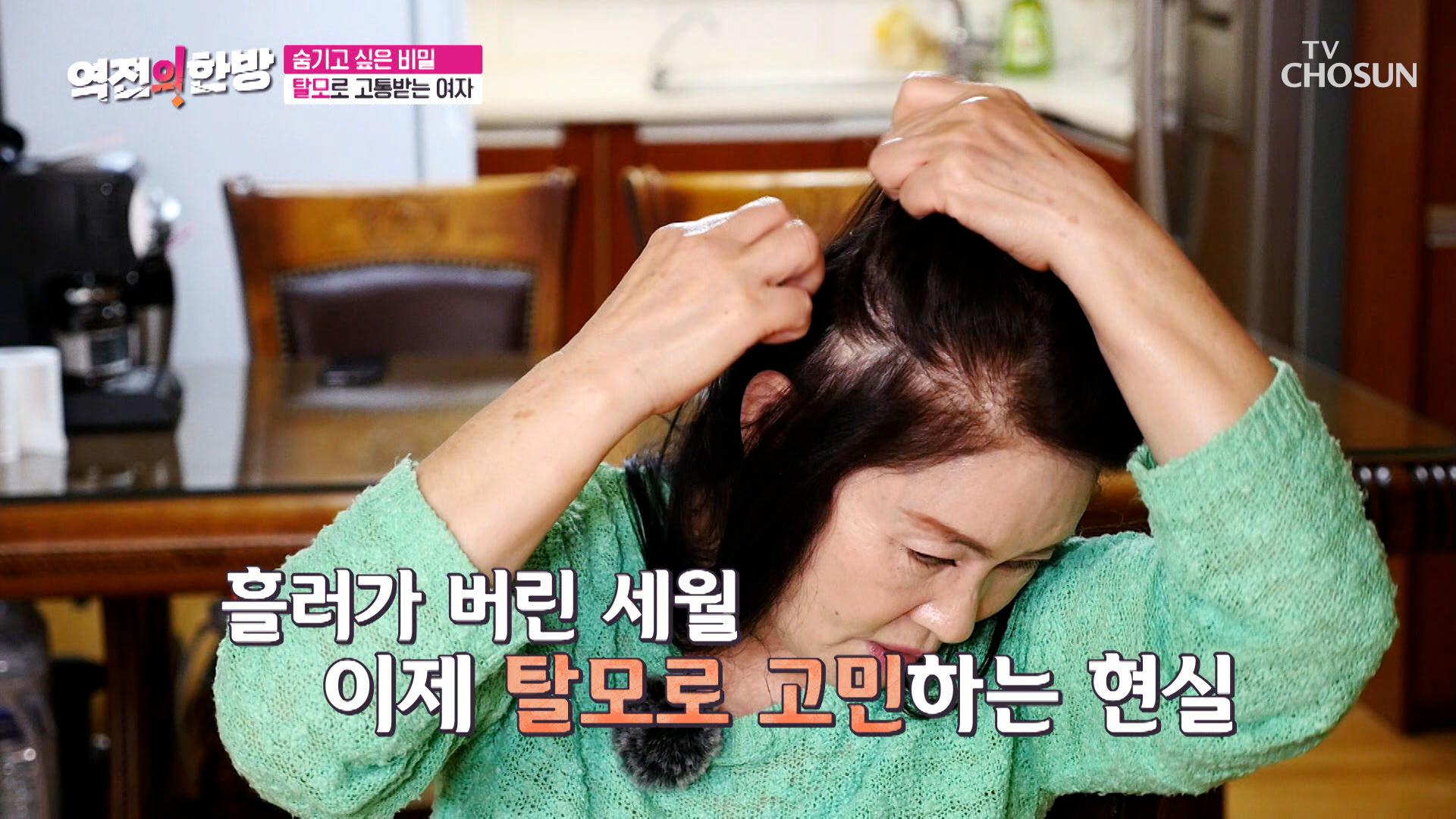 갑자기 찾아온 여성 탈모로 고통 받고 있는 주인공 TV CHOSUN 20221216 방송 | ZUM TV